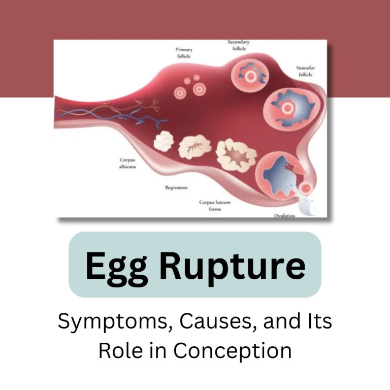 Egg Rupture: Symptoms, Causes, and Its Role in Conception - Dr ...